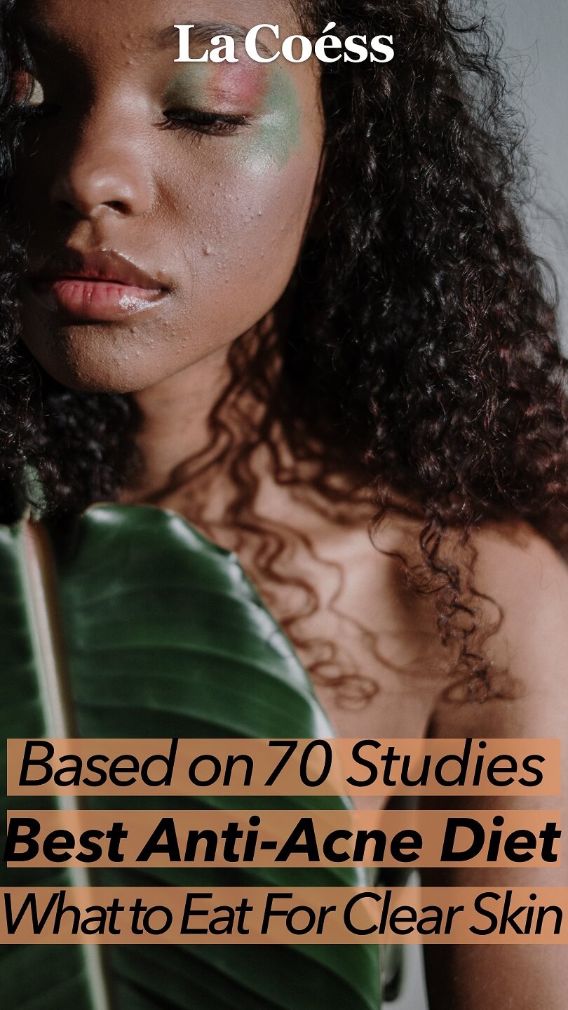 Best Anti-Acne Diet Based on 70 Studies - What to Eat For Clear Skin